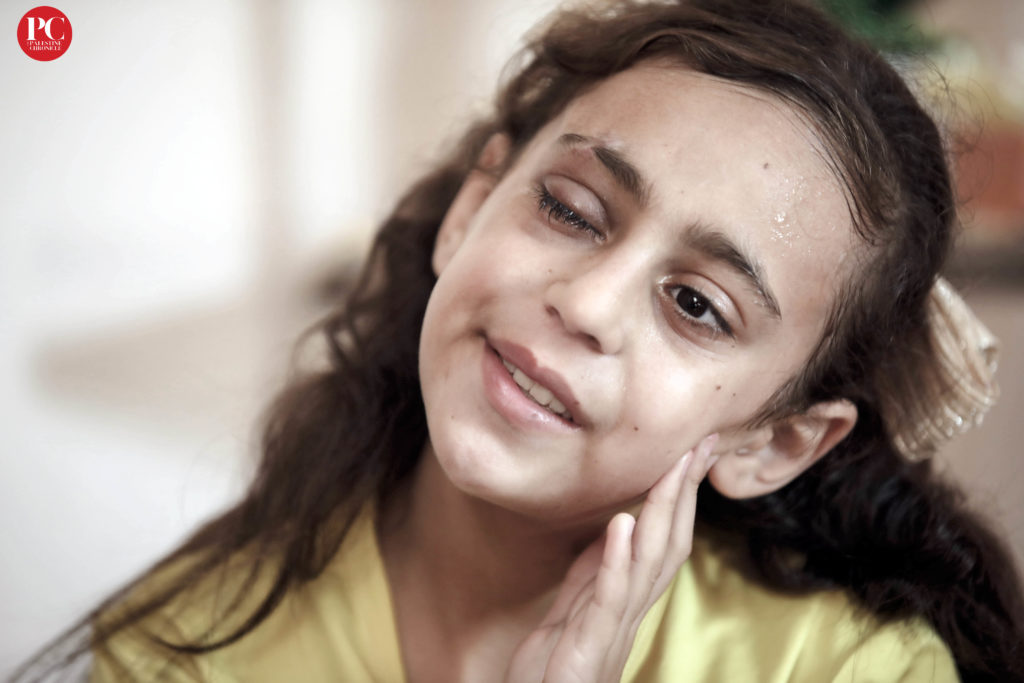 ‘My Life Will Never Be the Same’: Gaza Girl Who Lost Her Eye in Israeli ...