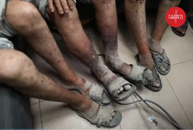 Five Killed in Gaza City Strike as Israel’s Ceasefire Violations Reach ...